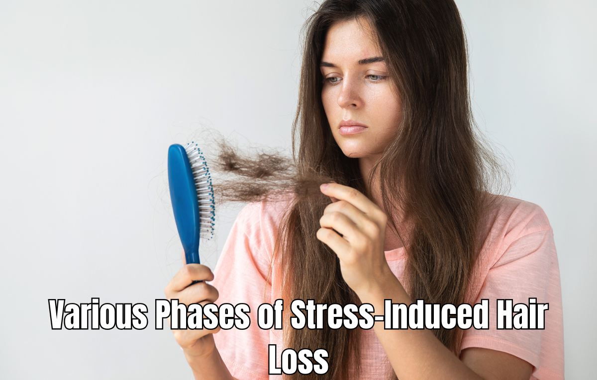 The Link Between Stress and Hair Loss: Causes and Solutions - HTI
